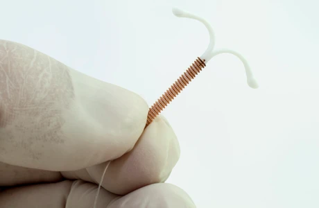 Kenali Apa Itu Intrauterine Device (IUD) dan Tipenya | HonestDocs
