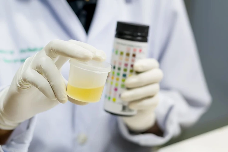 Ketahui Kondisi Kesehatan Tubuh Anda melalui Warna Urin | HonestDocs