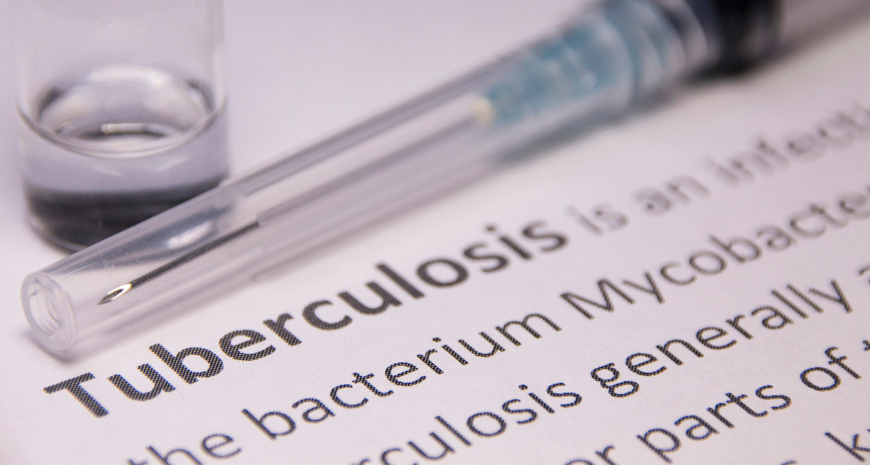 Pengobatan TBC Paru dan Ekstra Paru | HonestDocs