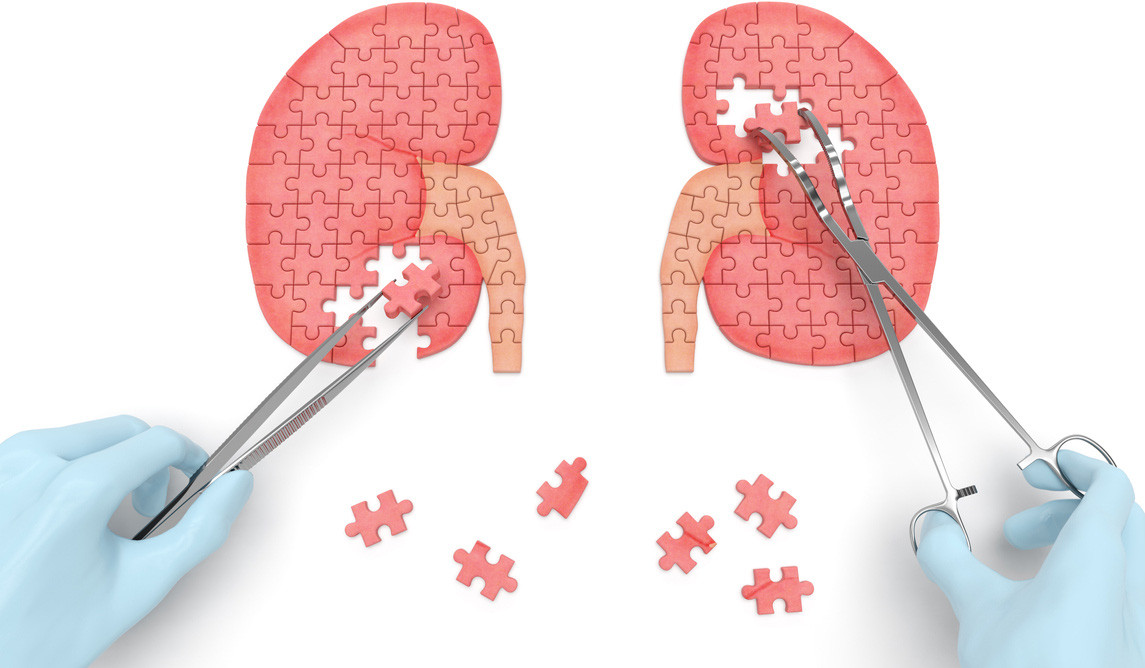 13 Fungsi Ginjal Yang Begitu Penting Bagi Tubuh | HonestDocs