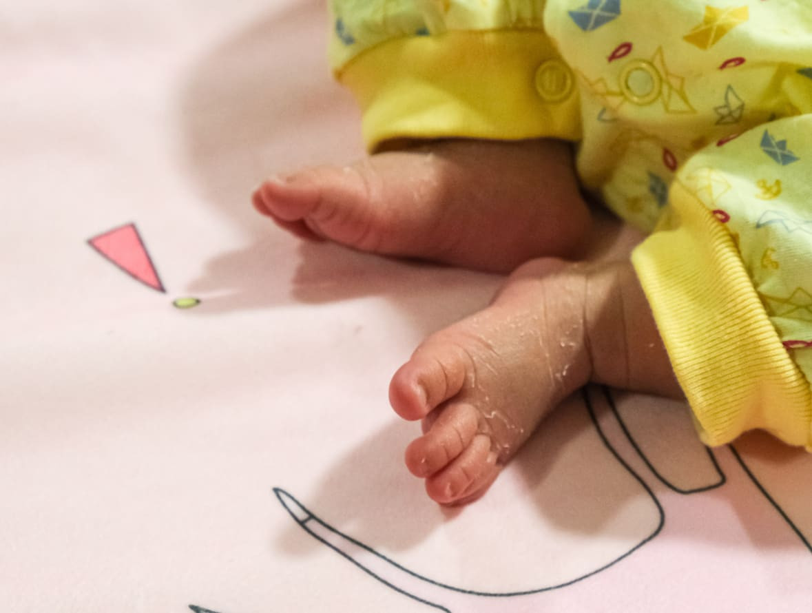 Cedera Jari Pada Anak: Penyebab, Gejala, dan Obat | HonestDocs