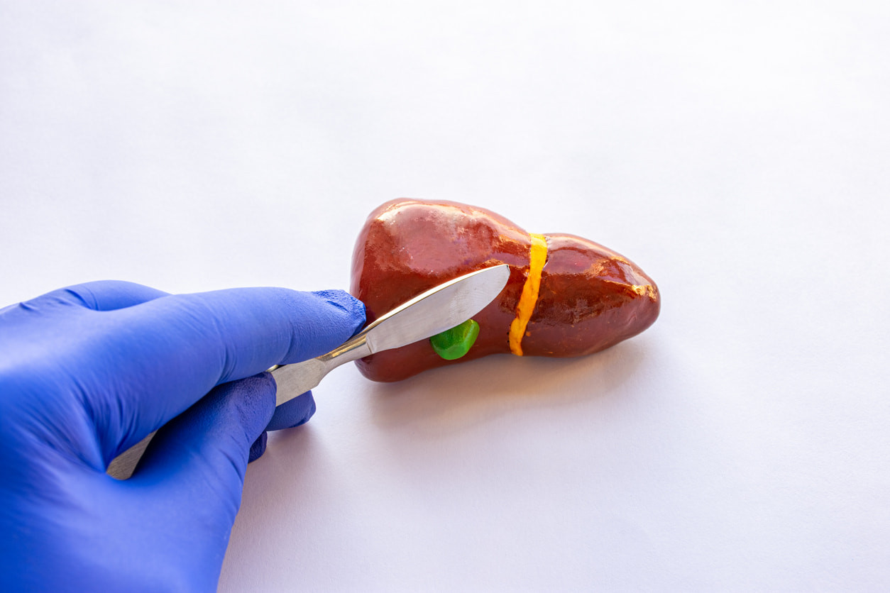 Abses Hepar, Waspadai Penyebab dan Gejalanya Sejak Awal | HonestDocs